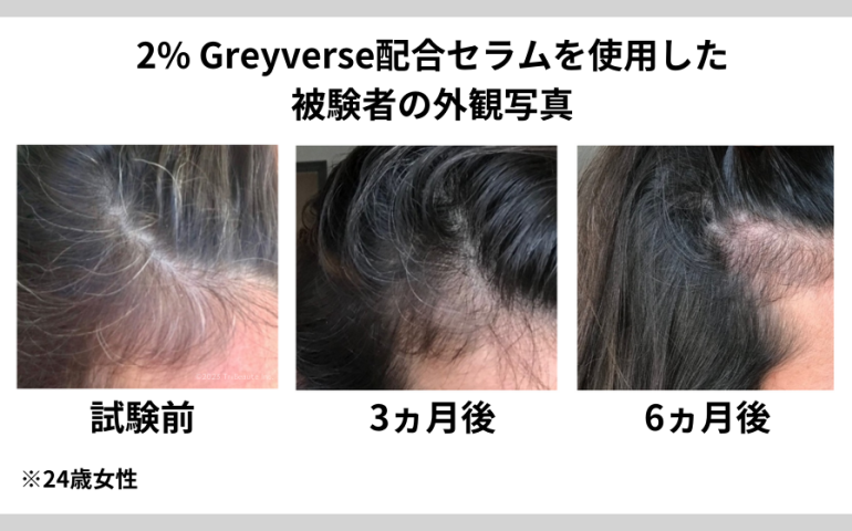 Greyverse（グレイバース） - Tribeaute(トライボーテ)